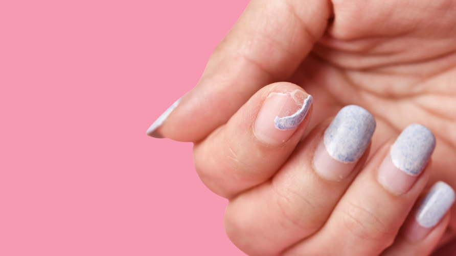 Why Are My Nails Separating? Everything You Need to Know About Onychol ...